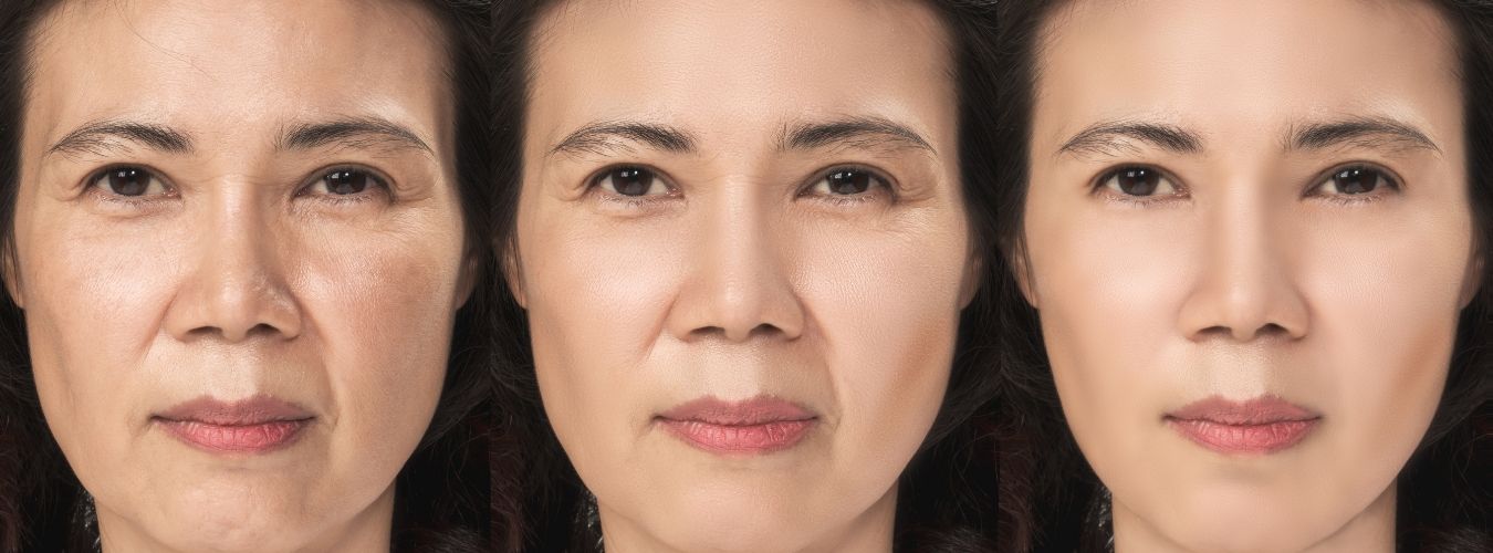 The Top 10 Cosmetic Treatments for Anti-Aging